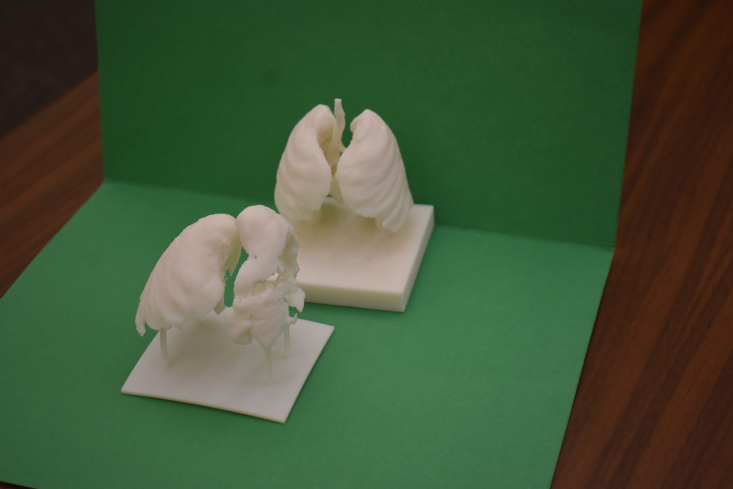 Modeling The Lungs Of A Covid Patient | News, Sports, Jobs - Post Journal